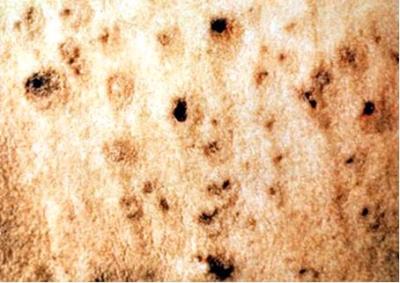 Pox Diseases | Infonet Biovision Home.