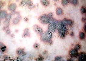 Pox Diseases | Infonet Biovision Home.