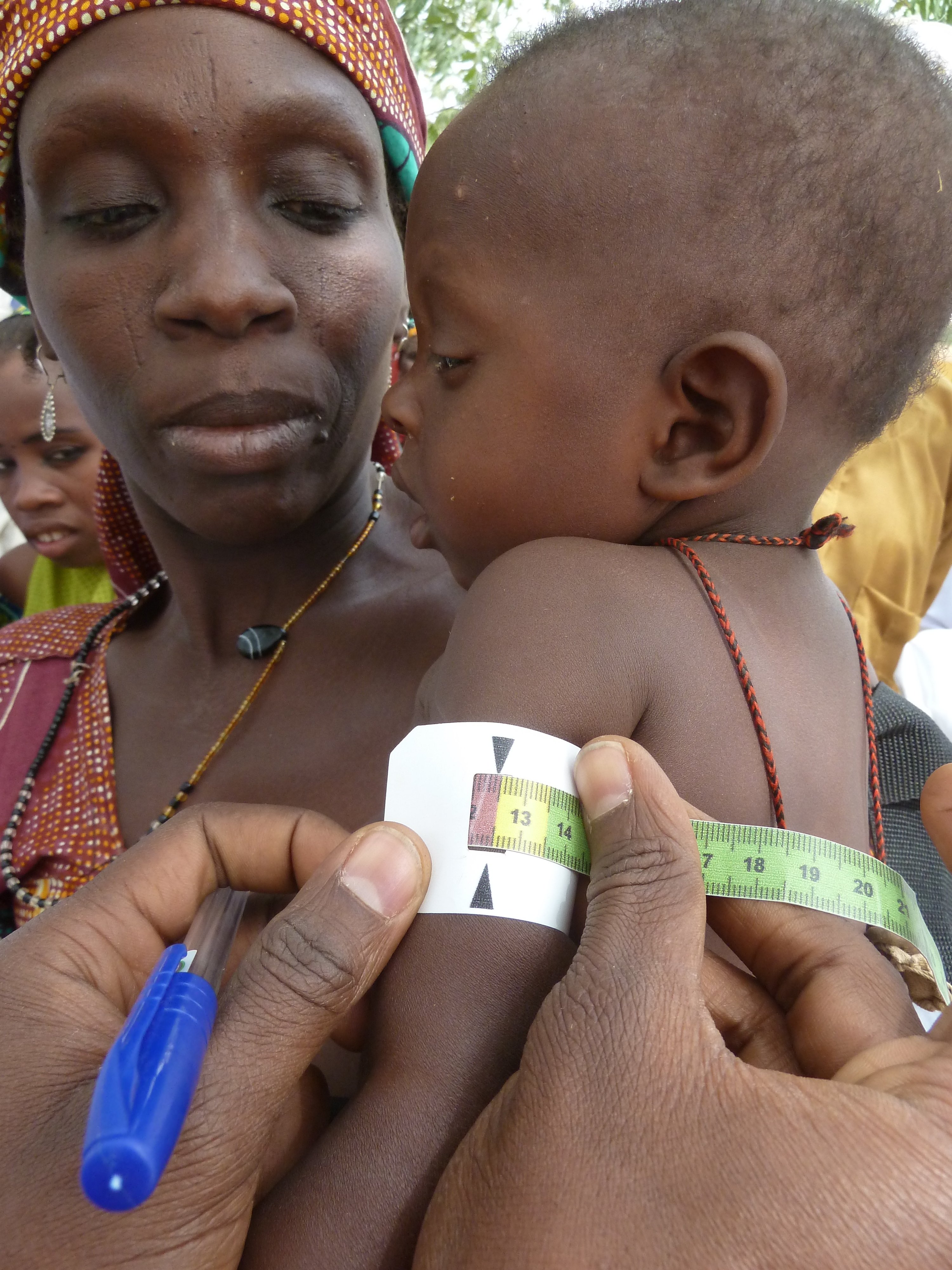 Malnutrition | Infonet Biovision Home.